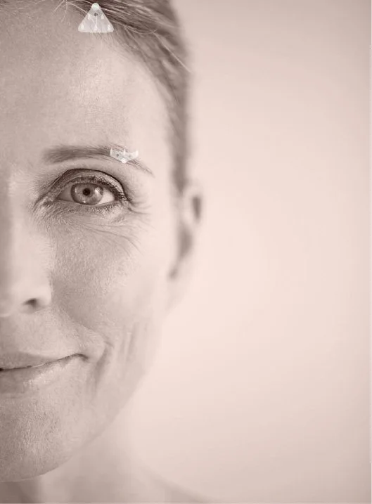 Endotine Surgery | Do you qualify for brow lift surgery? | Endotine®