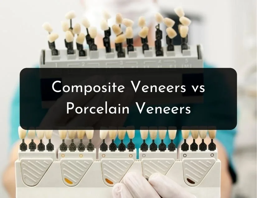 Composite Veneers Pros And Cons