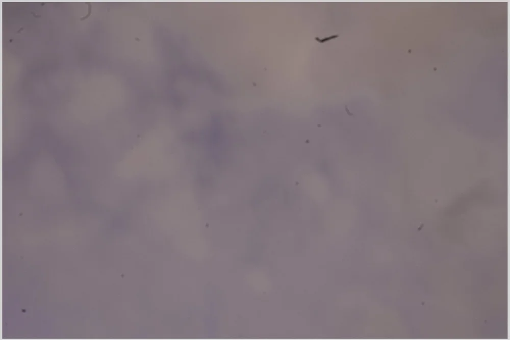 Camera Sensor Cleaning: The Ultimate Step-by-Step Guide