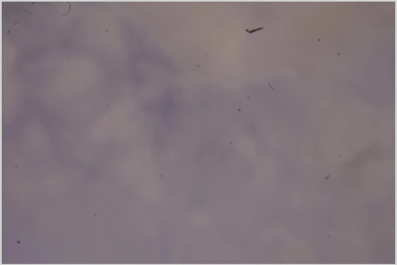 Camera Sensor Cleaning: The Ultimate Step-by-Step Guide