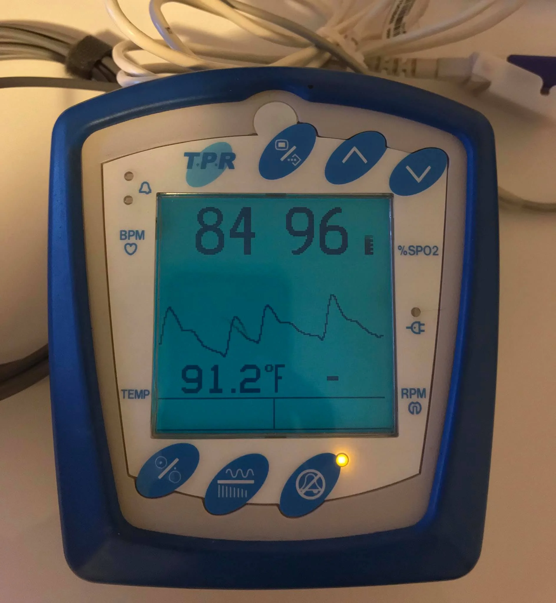 SOLD $450 SOLD S# 114 SurgiVet V3395 TPR Monitor with Heart Rate, Pulse ...