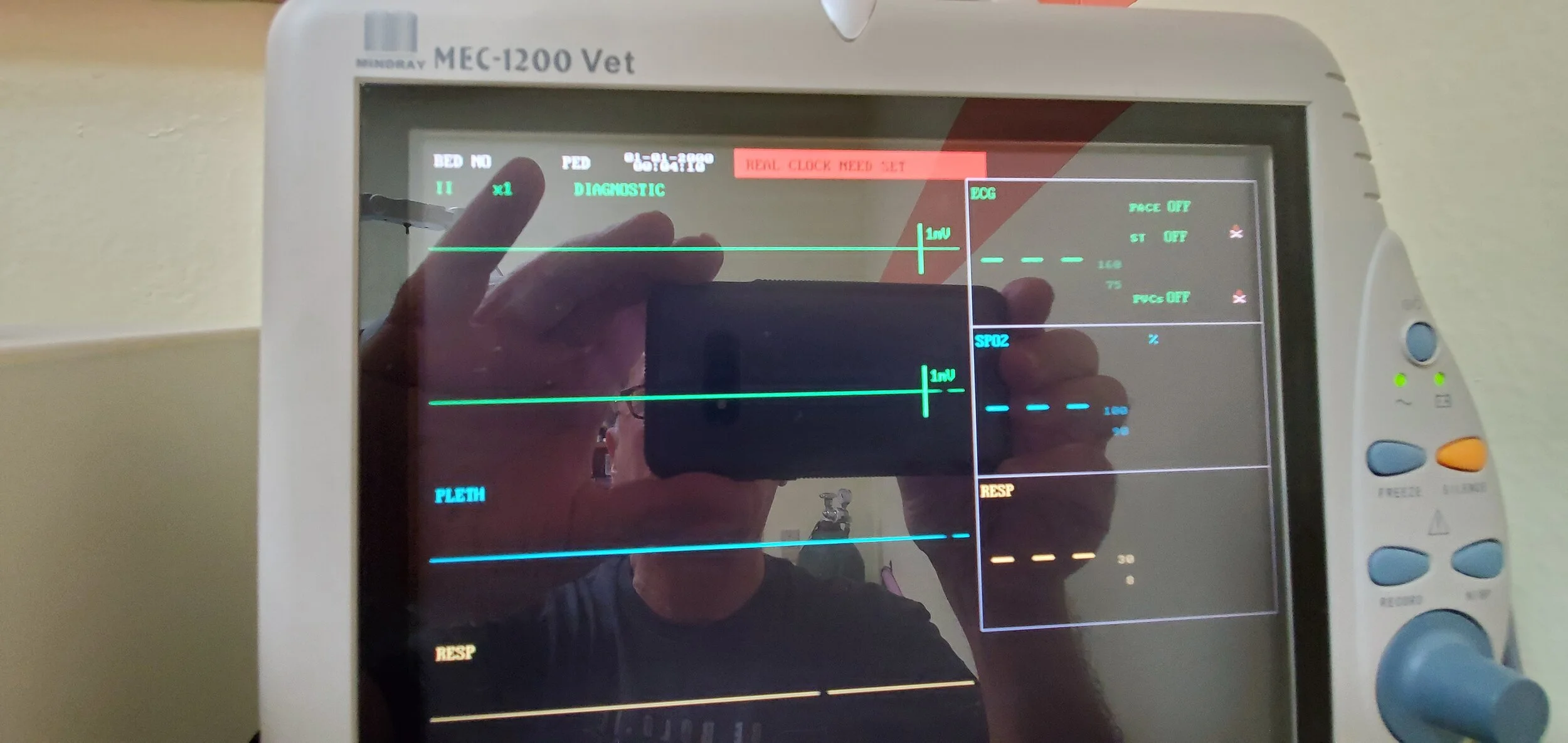 SOLD $ 700 SOLD 2010 Mindray MEC-1200 Monitor — Used Vet Equipment