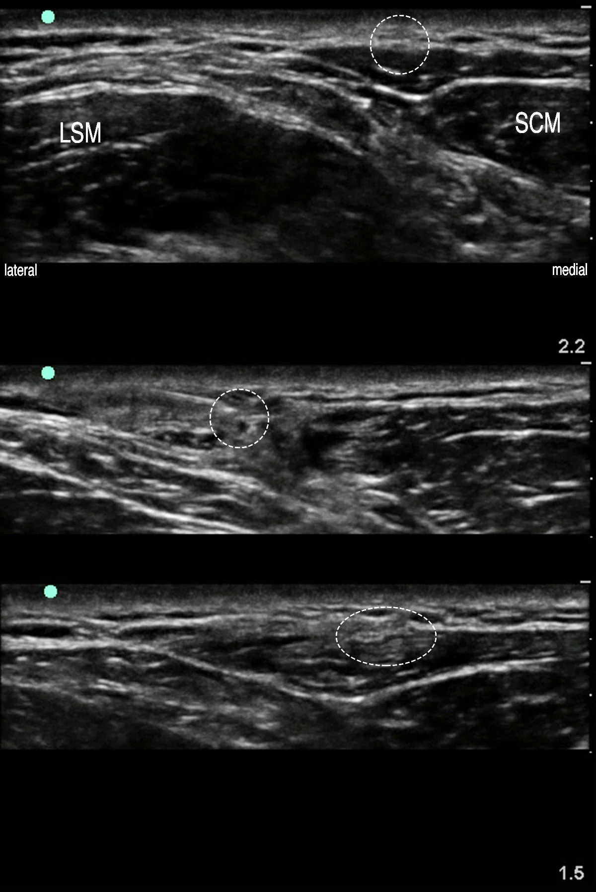 Face,Head & Neck — Highland EM Ultrasound Fueled pain management