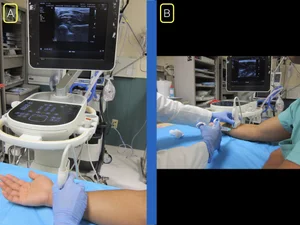 Forearm blocks — Highland EM Ultrasound Fueled pain management
