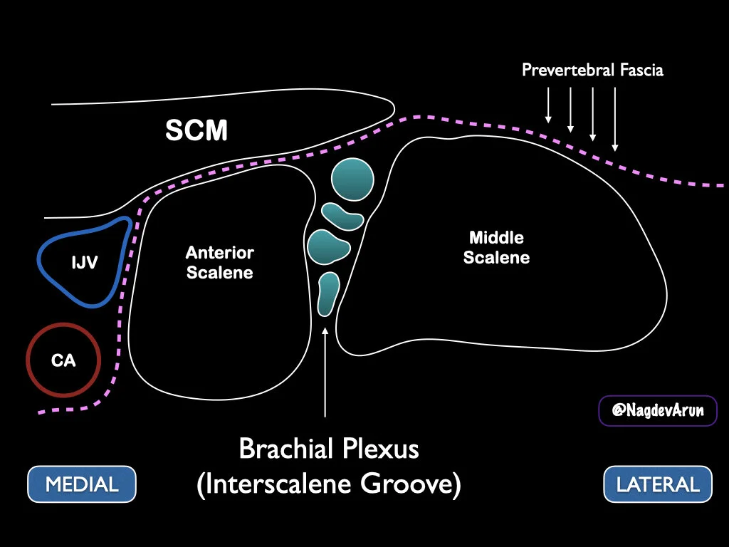 Interscalene — Highland EM Ultrasound Fueled pain management