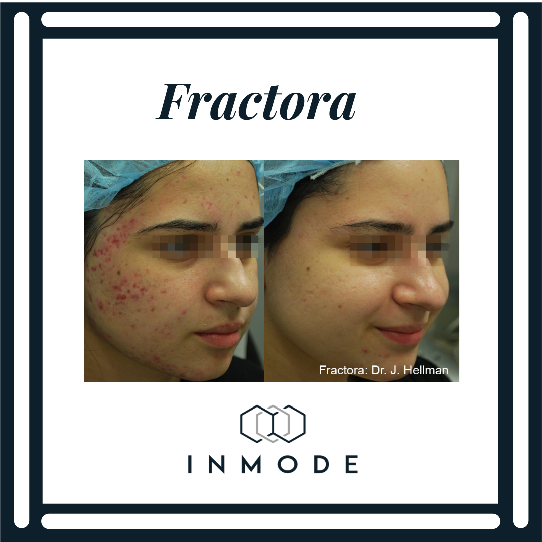 Esthetics — Chic Kingston