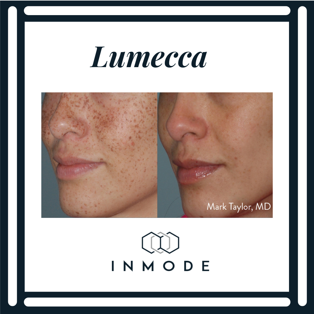 Esthetics — Chic Kingston