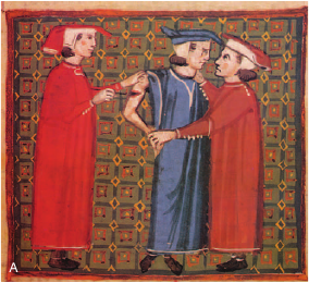 Image: "Operating on the Upper Arm," which originally appeared in the ...