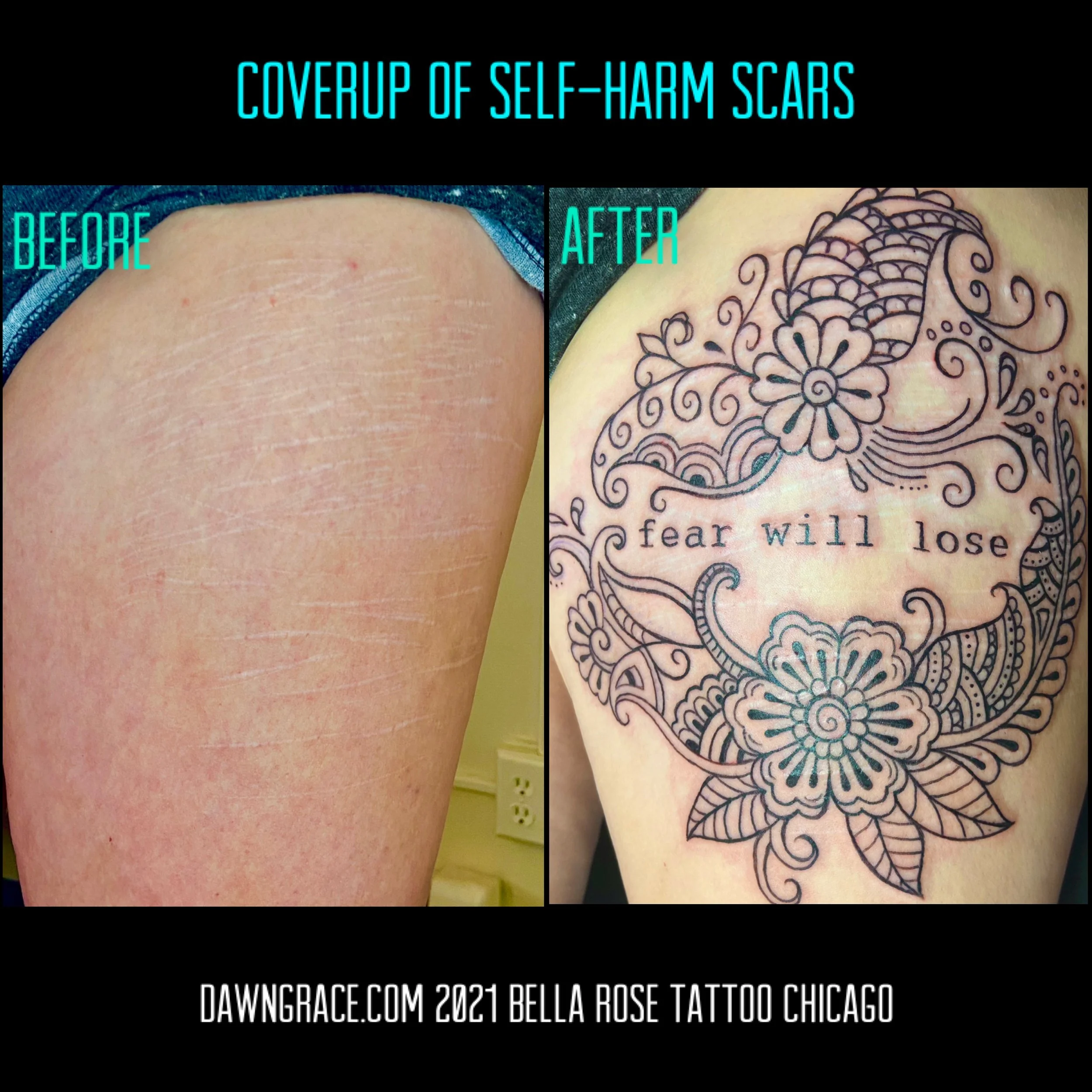 self-harm scar coverups — bella rose tattoo