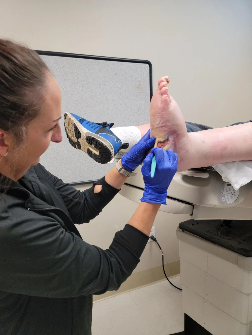 Debridement: How can we help a wound heal by making it larger ...