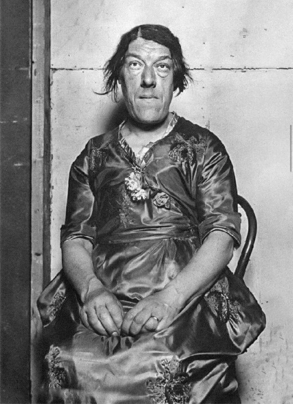 The Sad Story of How Mary Ann Bevan Was Chosen as the “World’s Ugliest ...