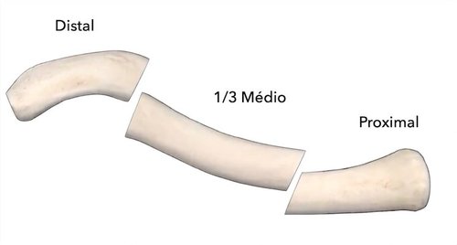 Fratura da clavícula — Dr. Mauro Gracitelli