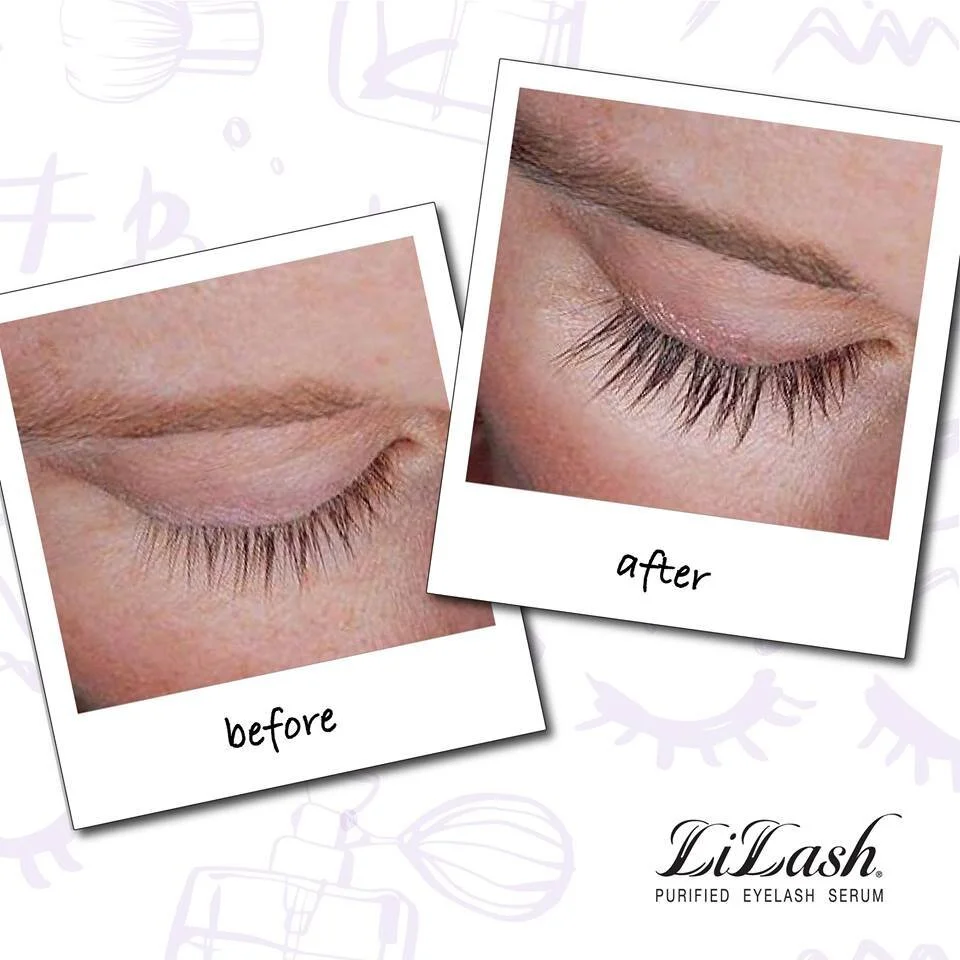 LiLash Purified Eyelash Growth Serum — TLC Beauty Therapy | LiLash UK