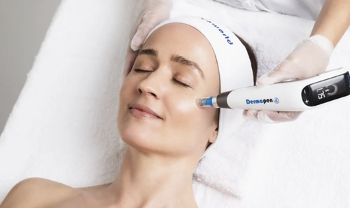 Skin Needling Gladstone | Dermapen 4 | MizHitch | Advanced Skin ...