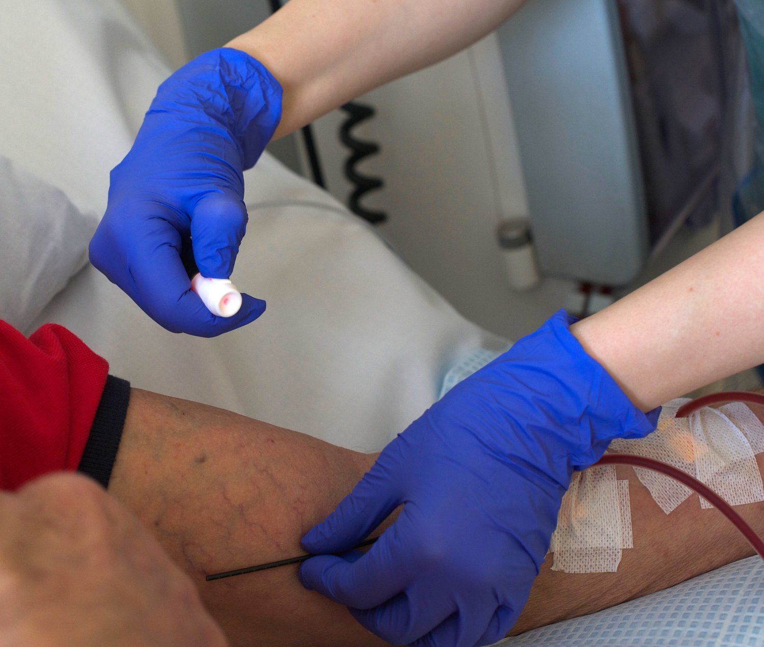 KidneyBuzz.com: Chronic Kidney Disease Information, Dialysis Tips ...