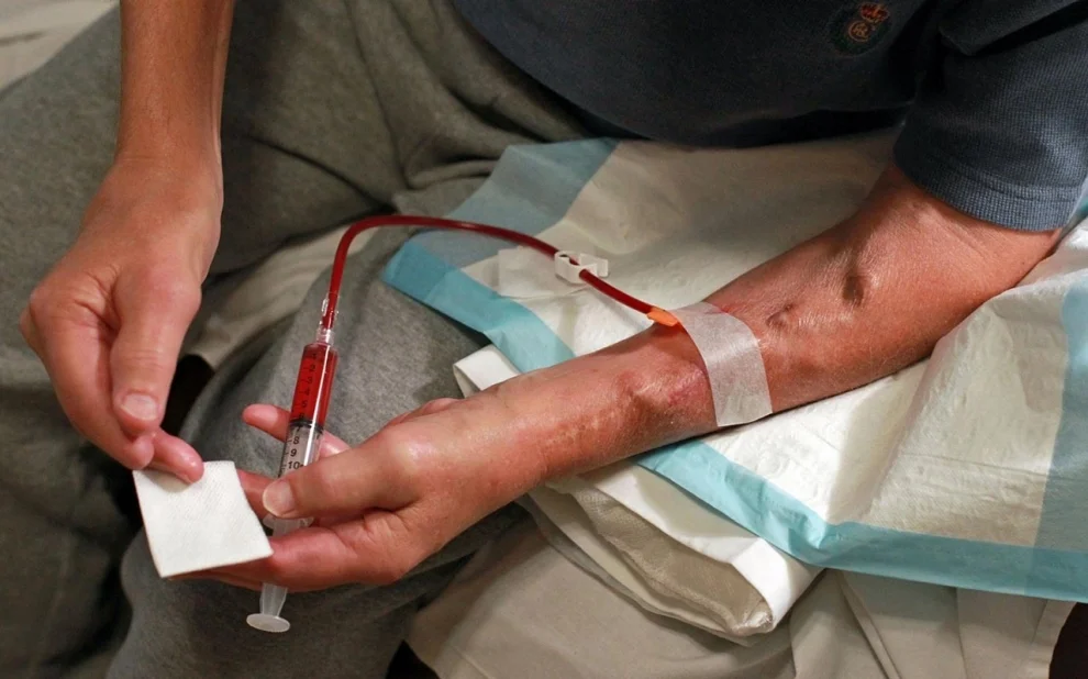 KidneyBuzz.com: Chronic Kidney Disease Information, Dialysis Tips ...