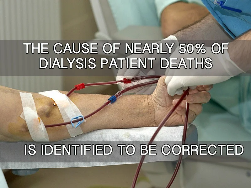 KidneyBuzz.com: Chronic Kidney Disease Information, Dialysis Tips ...