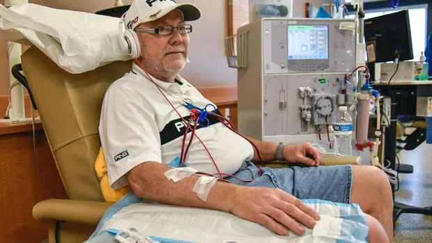 KidneyBuzz.com: Chronic Kidney Disease Information, Dialysis Tips ...