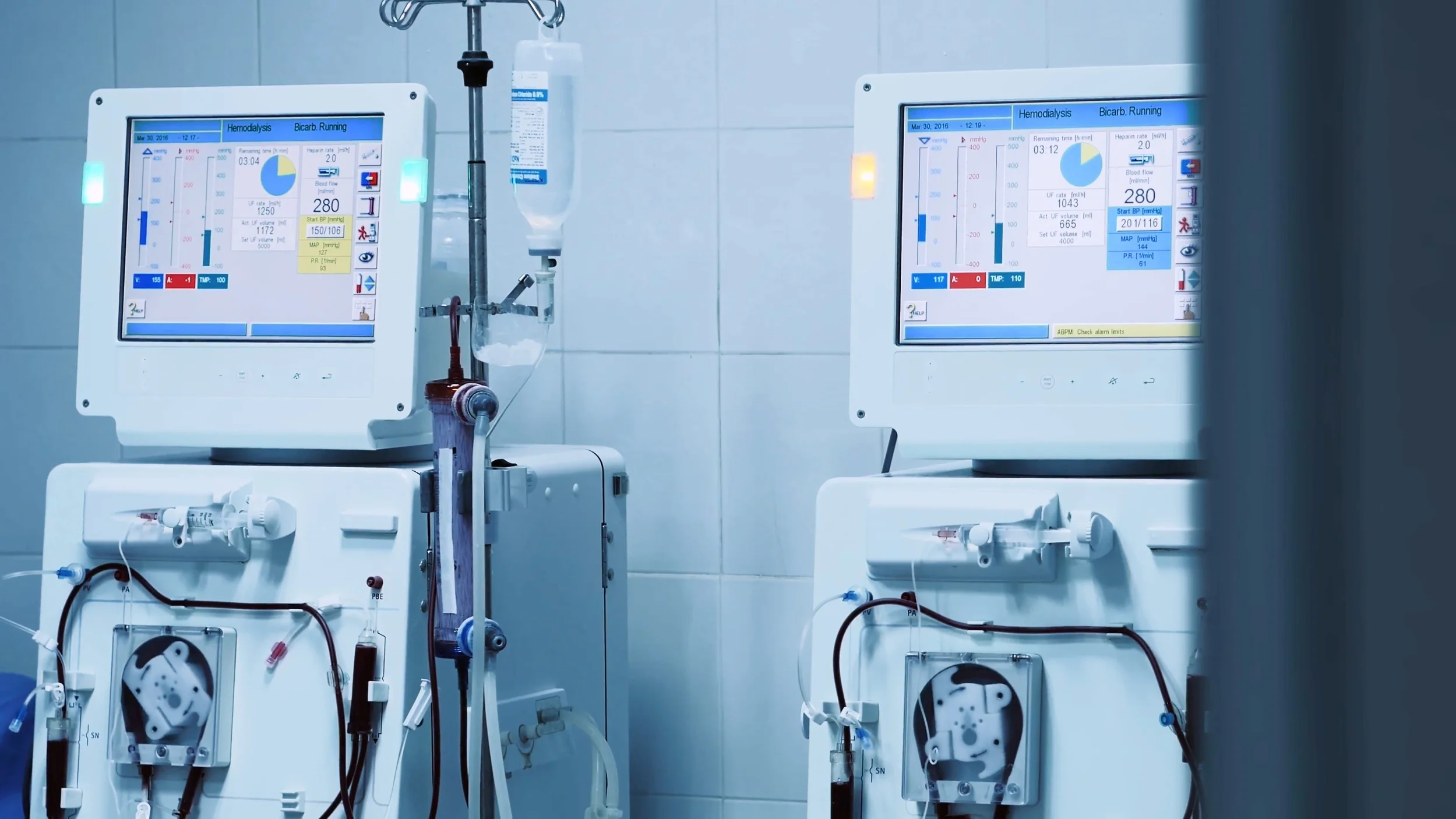 KidneyBuzz.com: Chronic Kidney Disease Information, Dialysis Tips ...