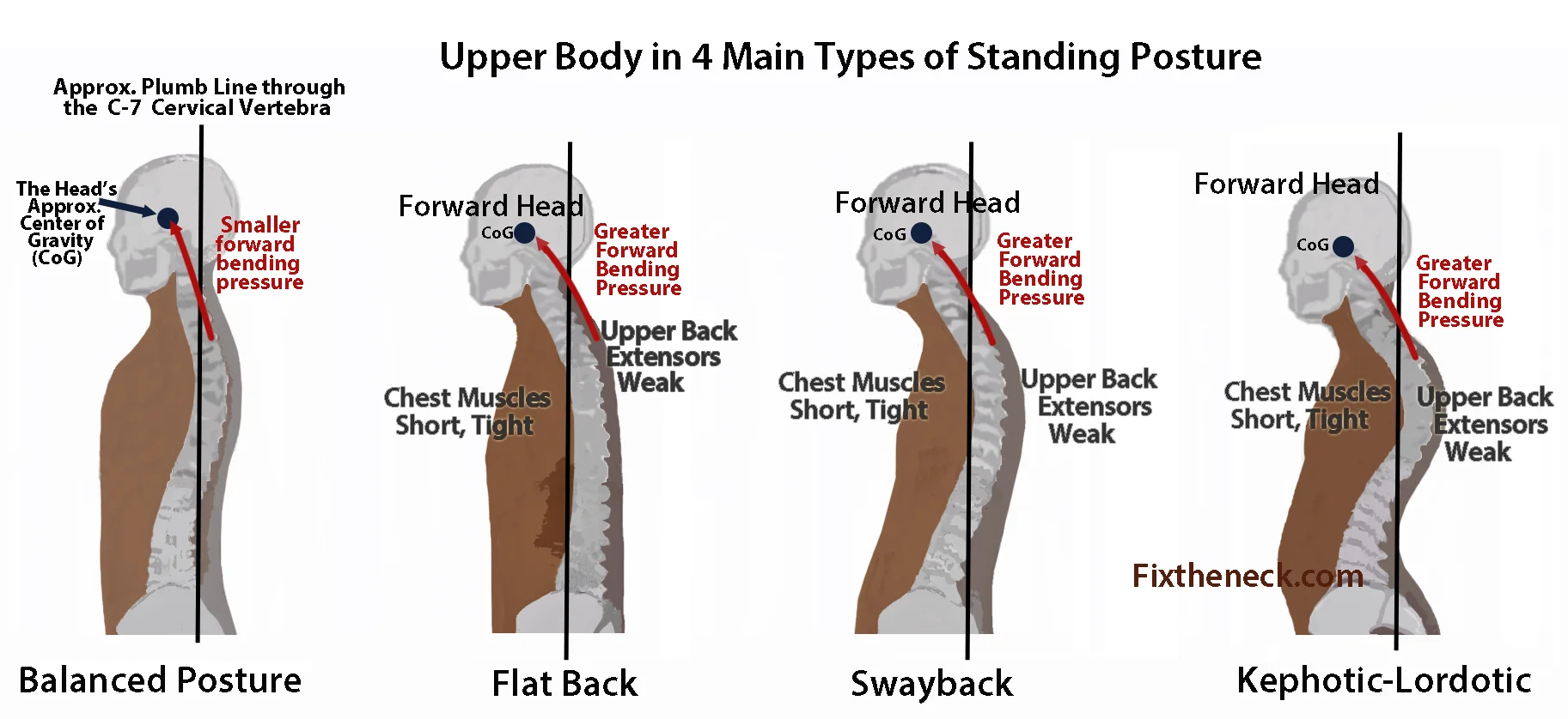 Yoga For Neck Pain Katie Fraumann New York Yoga Instructor