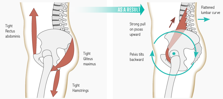 Psoas Talk with Christye — Volt Performance Blog