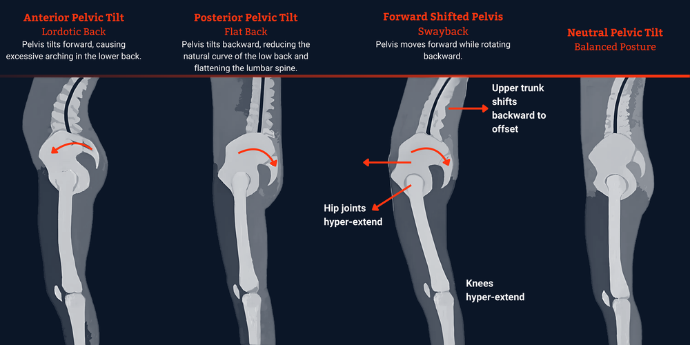 Psoas Talk with Christye: Is Your Athlete's Hip Pain a Flexibility or ...