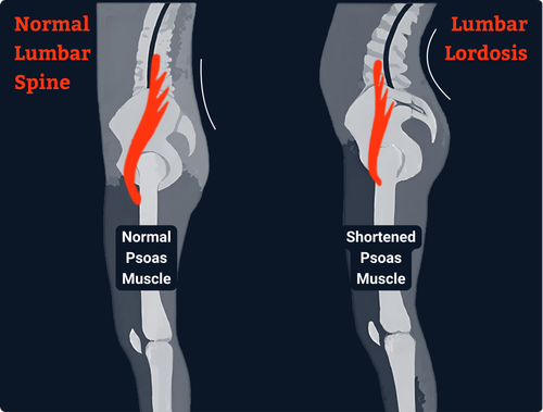 Psoas Talk with Christye: Is Your Athlete's Hip Pain a Flexibility or ...