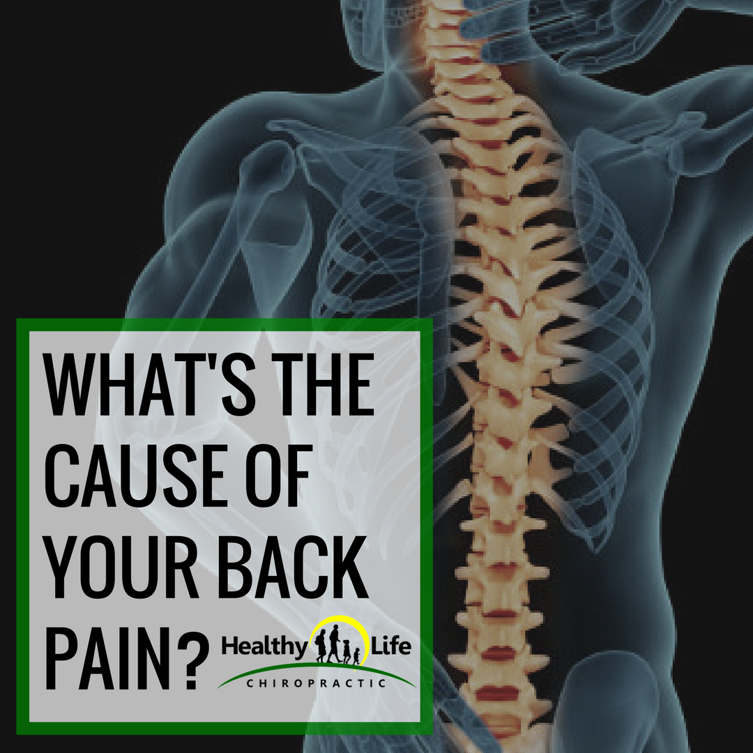What's the Cause of your Back Pain? — Healthy Life Chiropractic