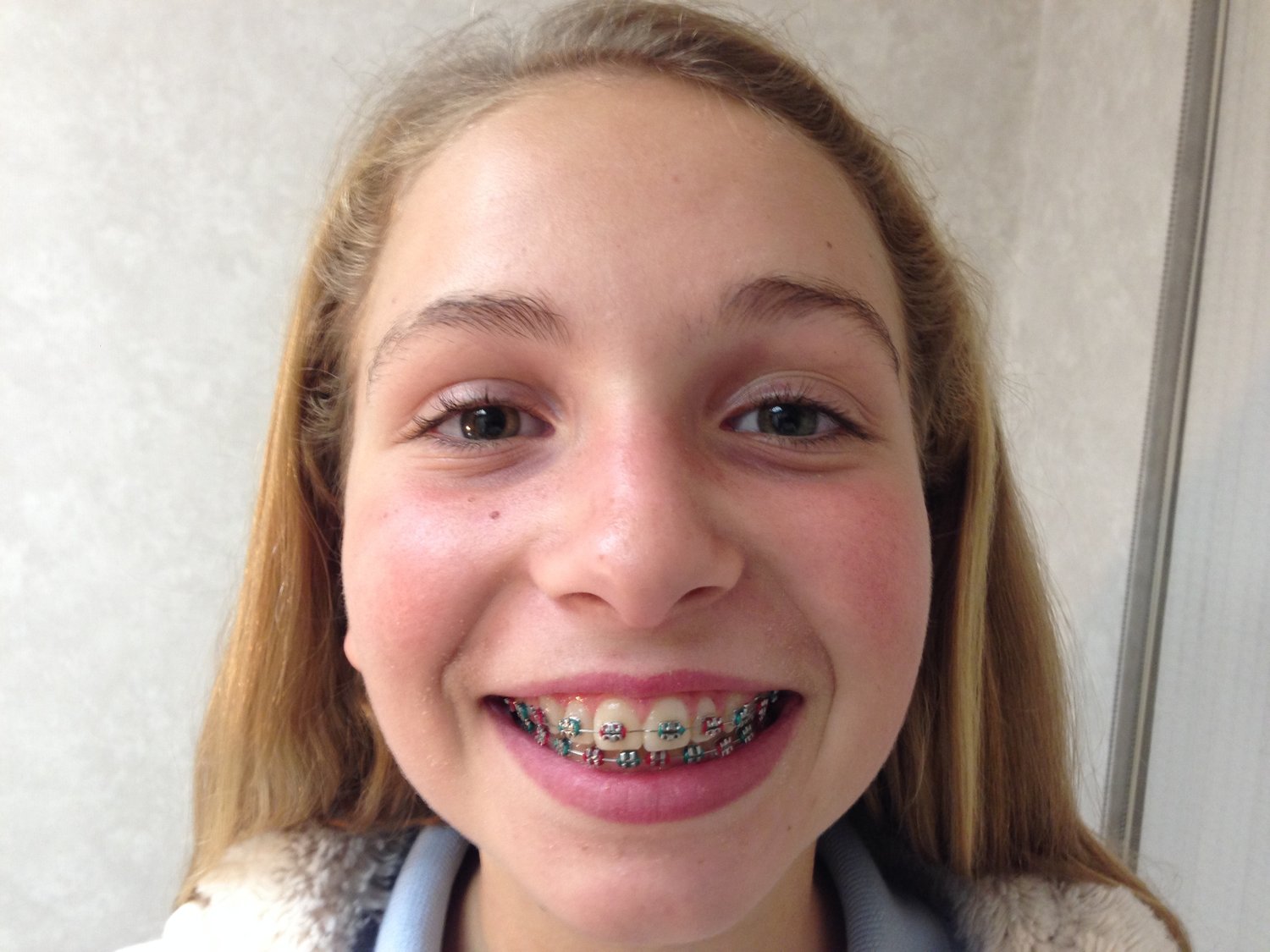 Our first Christmas colored braces!! — Dr. Geoffrey Halberstadt, D.D.S.