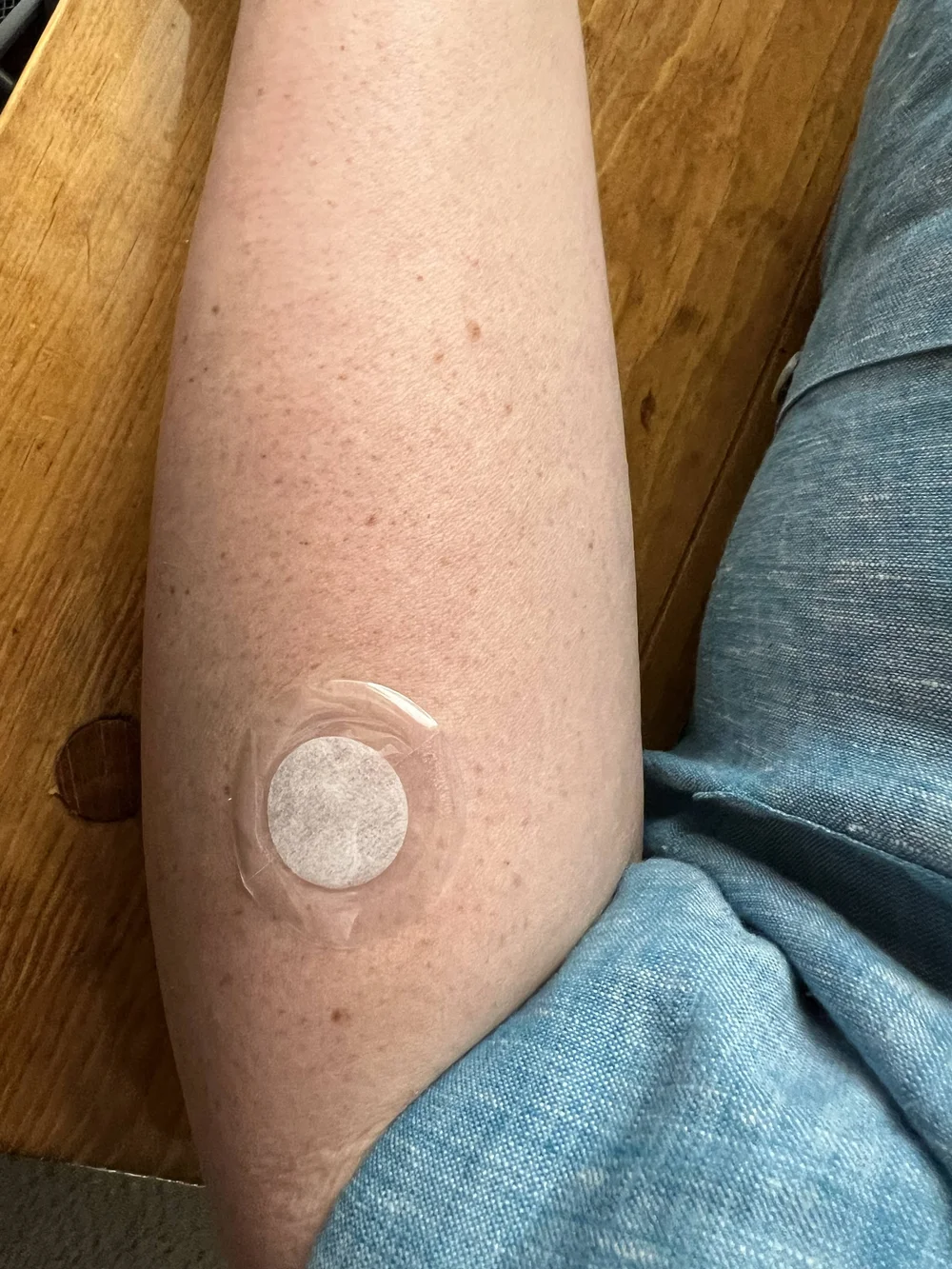 Acu Patches | Napa Acupuncture Practice