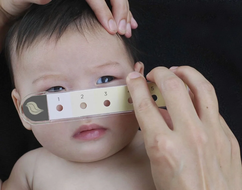 icterometer bili-ruler™ - Little Sparrows Technologies