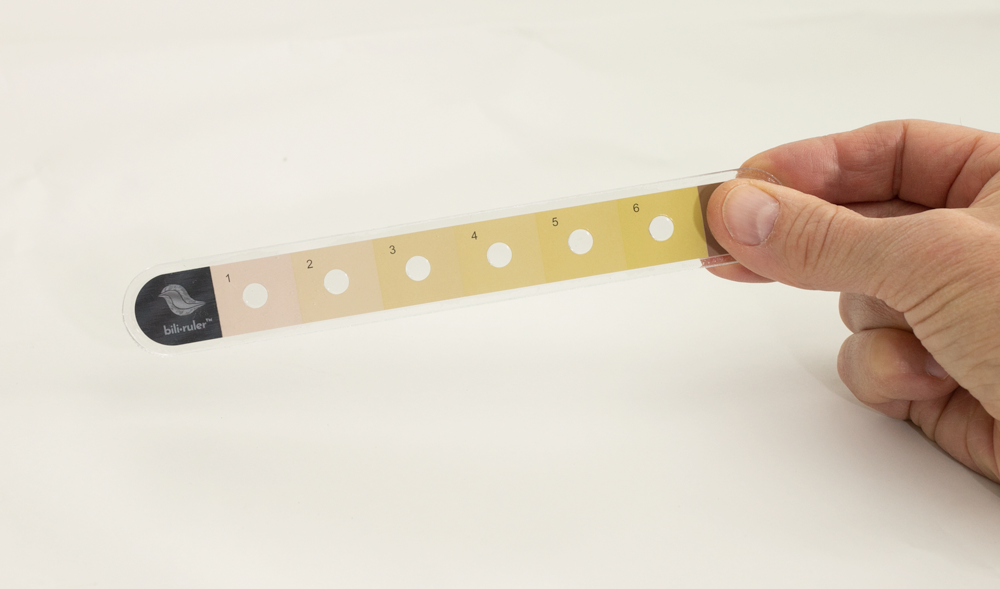 icterometer bili-ruler™ - Little Sparrows Technologies