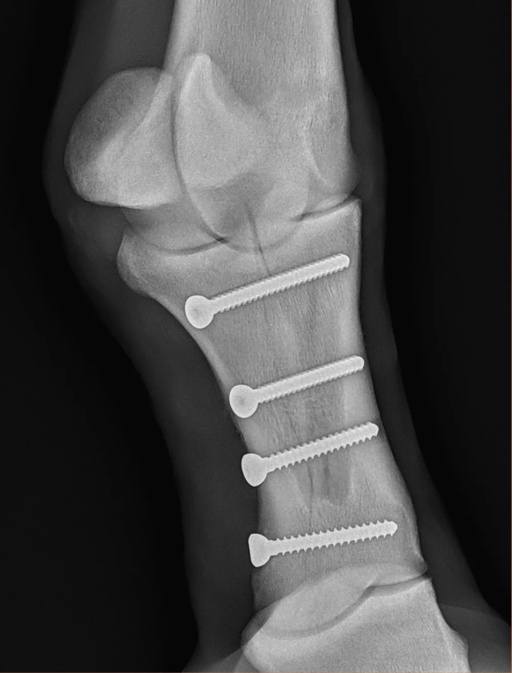 Fracture — North American Article Index | Trainer Magazine