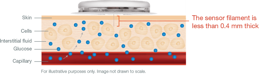 Medical Device Adhesive Patches that Stay Put — Fusion Design
