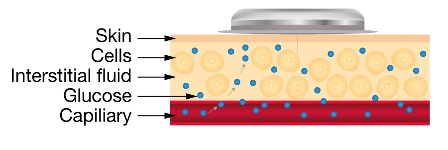 Medical Device Adhesive Patches that Stay Put — Fusion Design