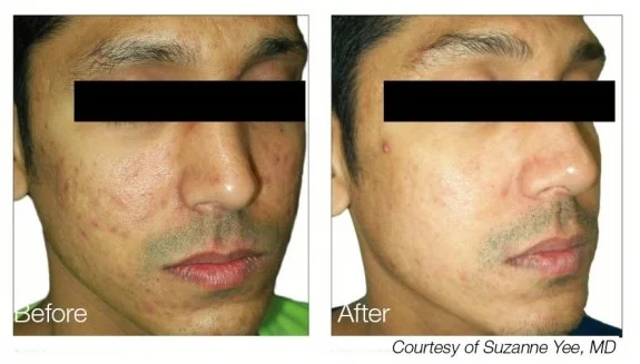 Plastic Surgery of Texas - Dr. Tittle