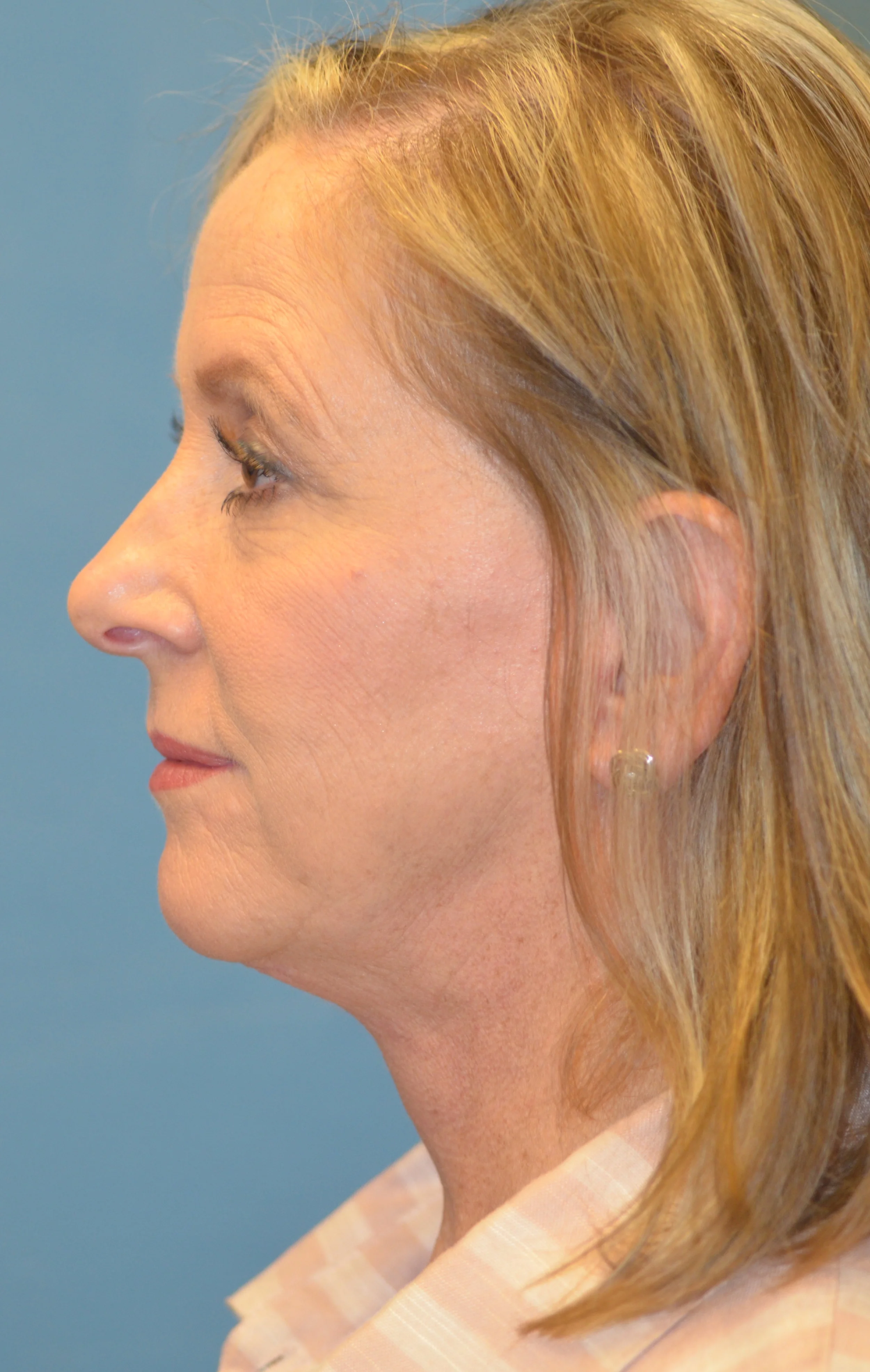 Plastic Surgery of Texas - Dr. Tittle