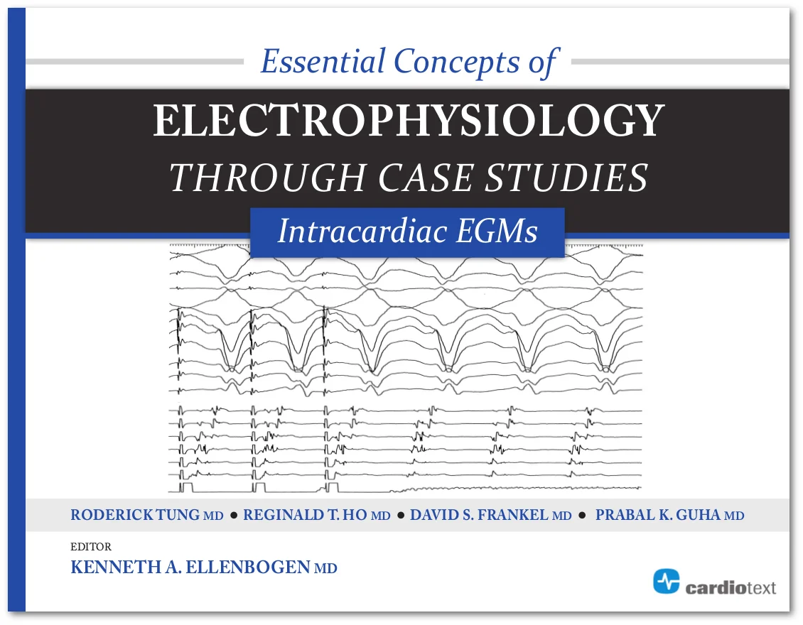 Essential Concepts of Electrophysiology and Pacing through Case Studies ...