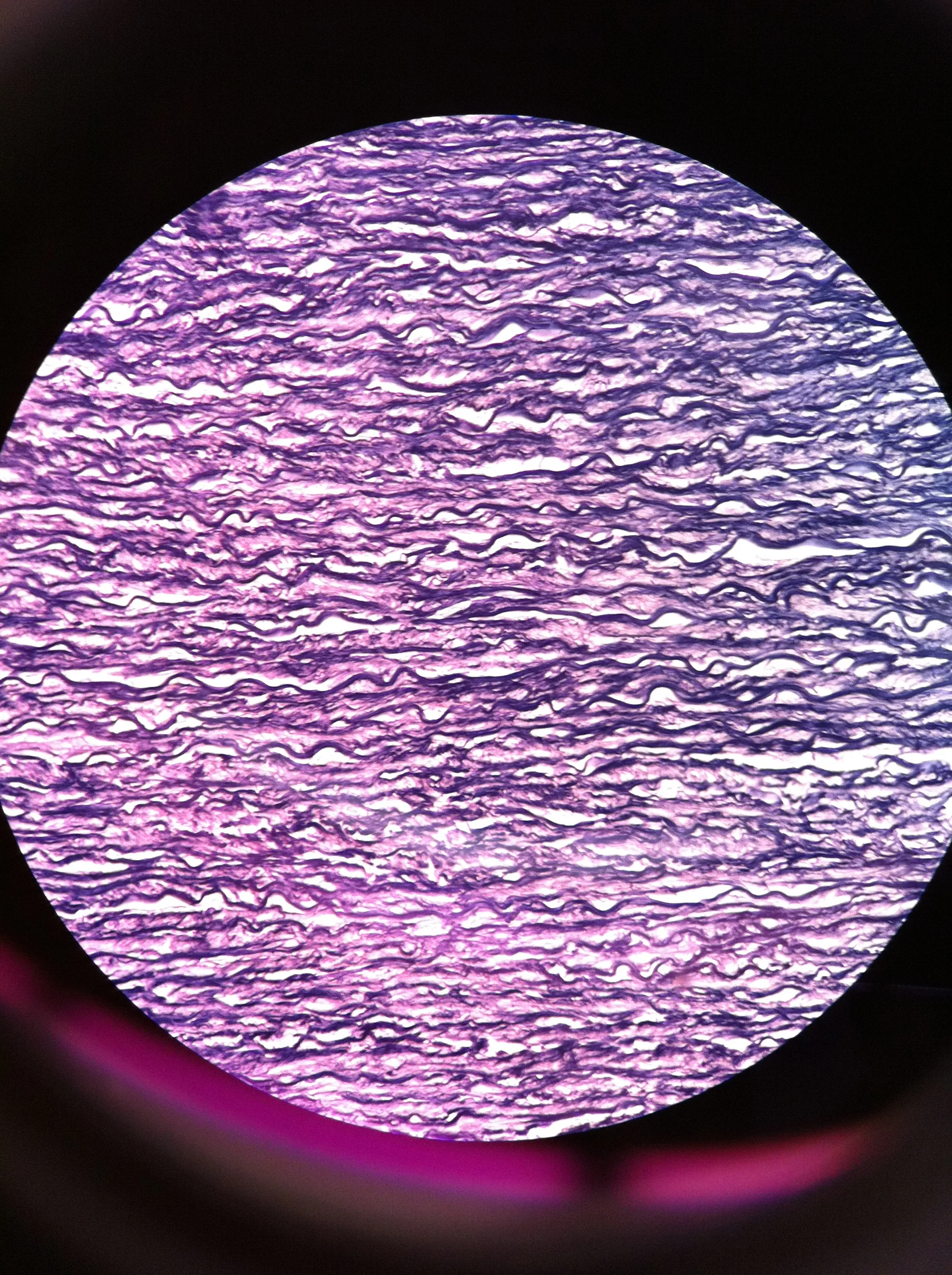 Dense Regular Connective Tissue 400x Labeled
