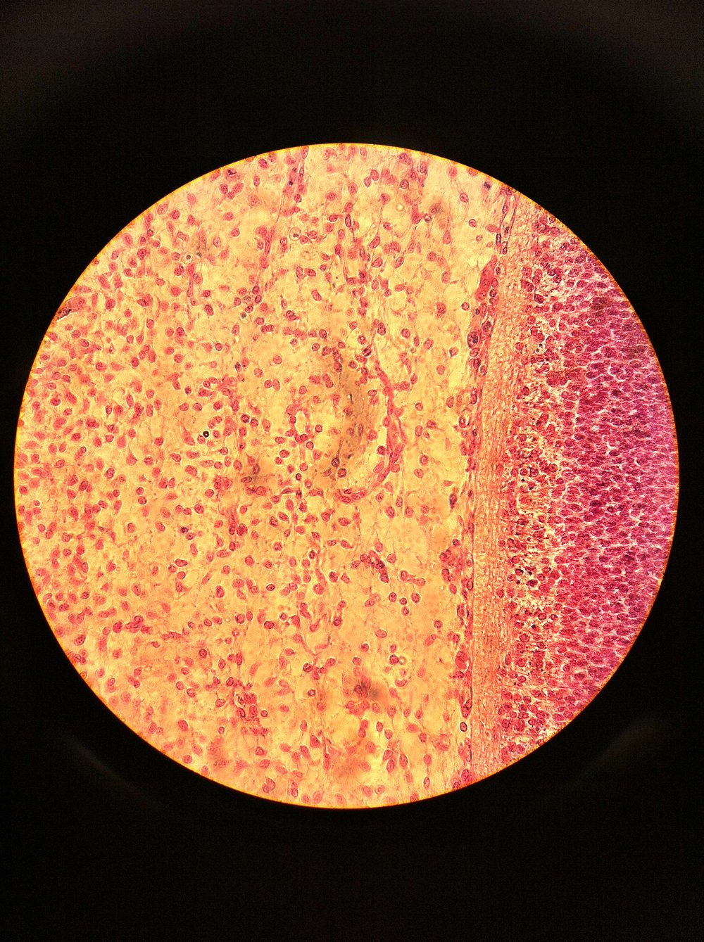 Adipose Tissue Slide 400x