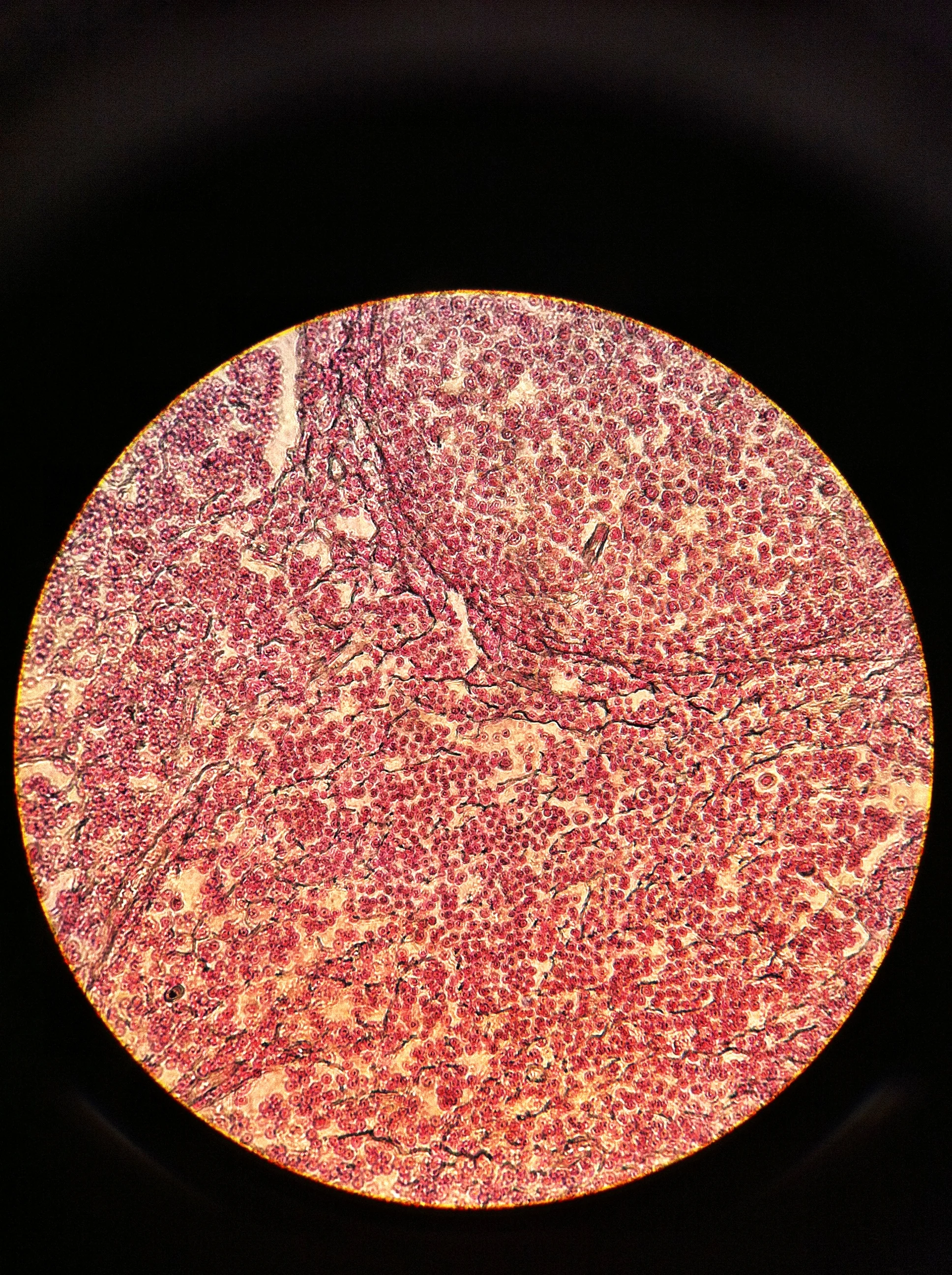 Connective Tissues — See Why Anatomy