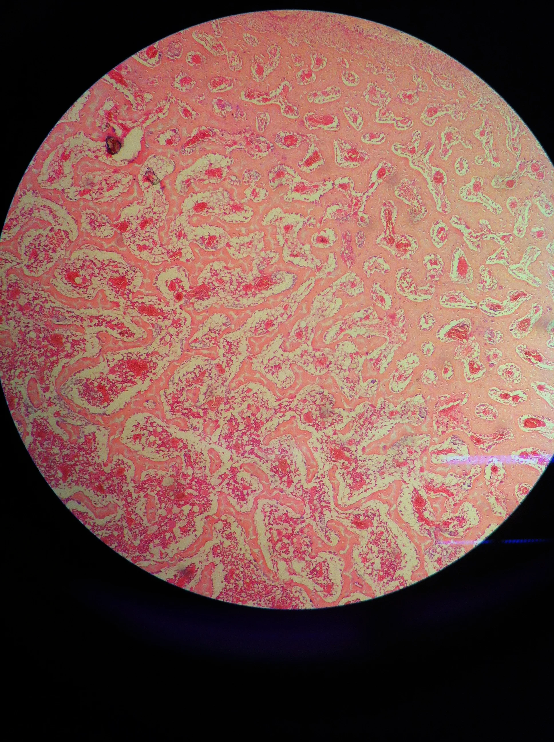 Bone Anatomy — See Why Anatomy