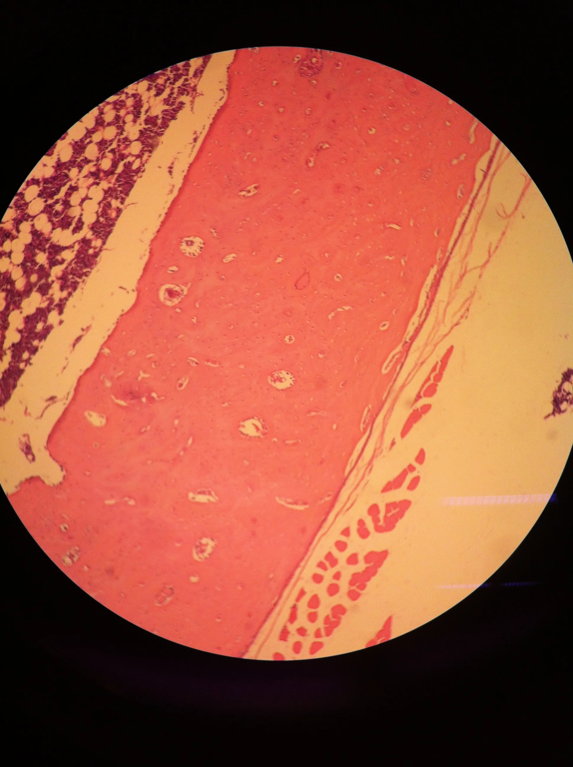 Bone Anatomy — See Why Anatomy