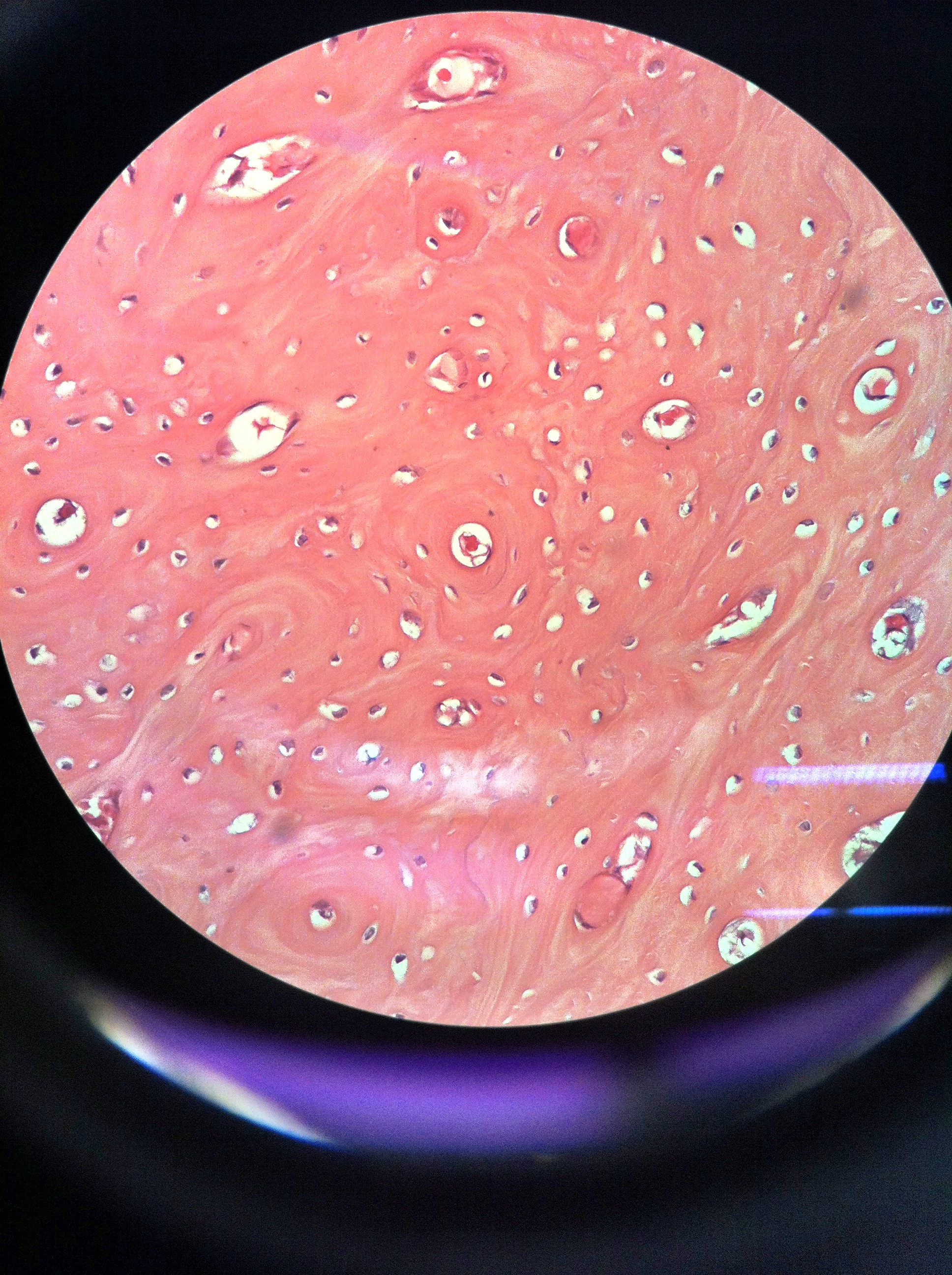 Bone Anatomy — See Why Anatomy