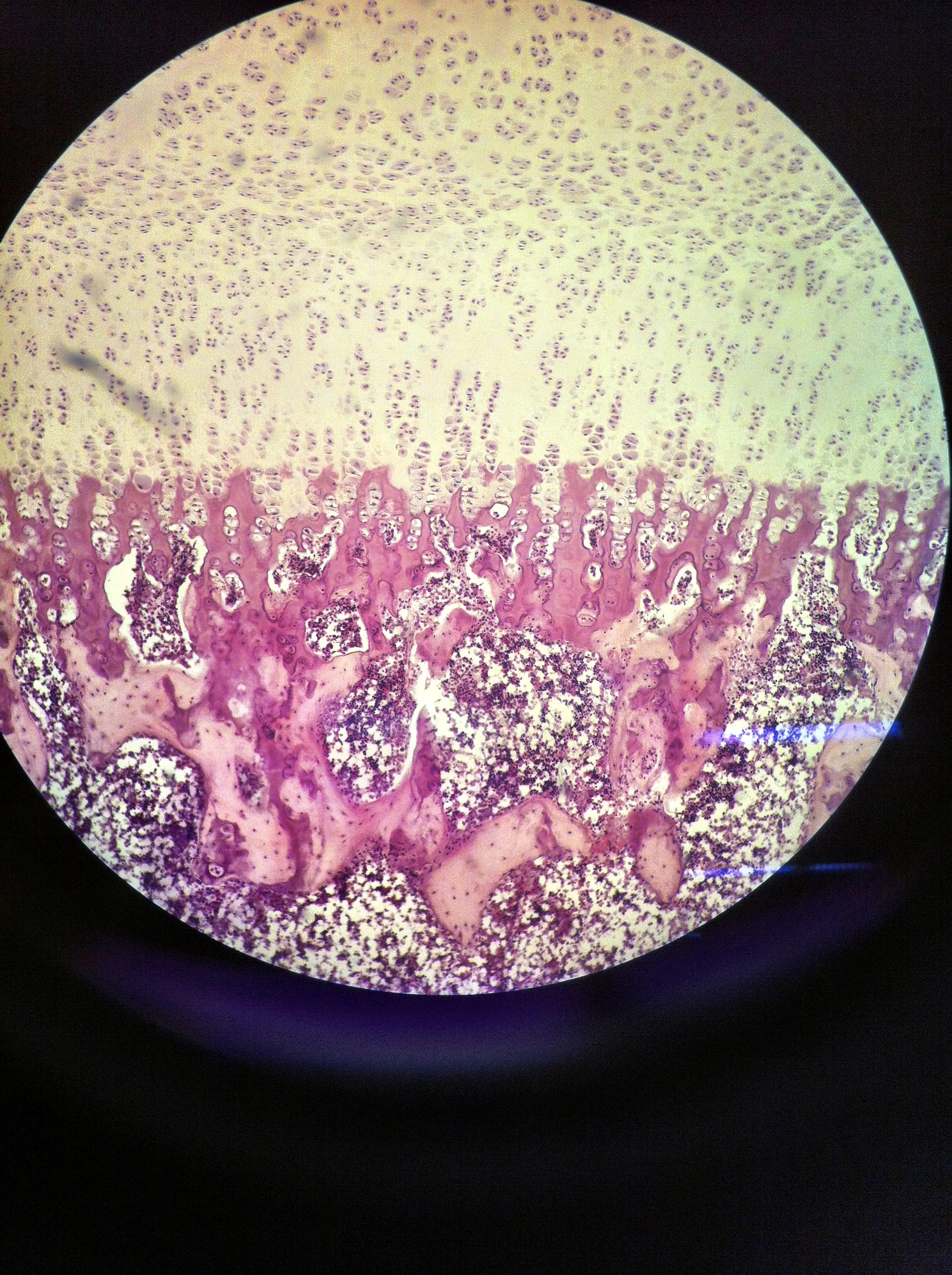 Bone Anatomy — See Why Anatomy