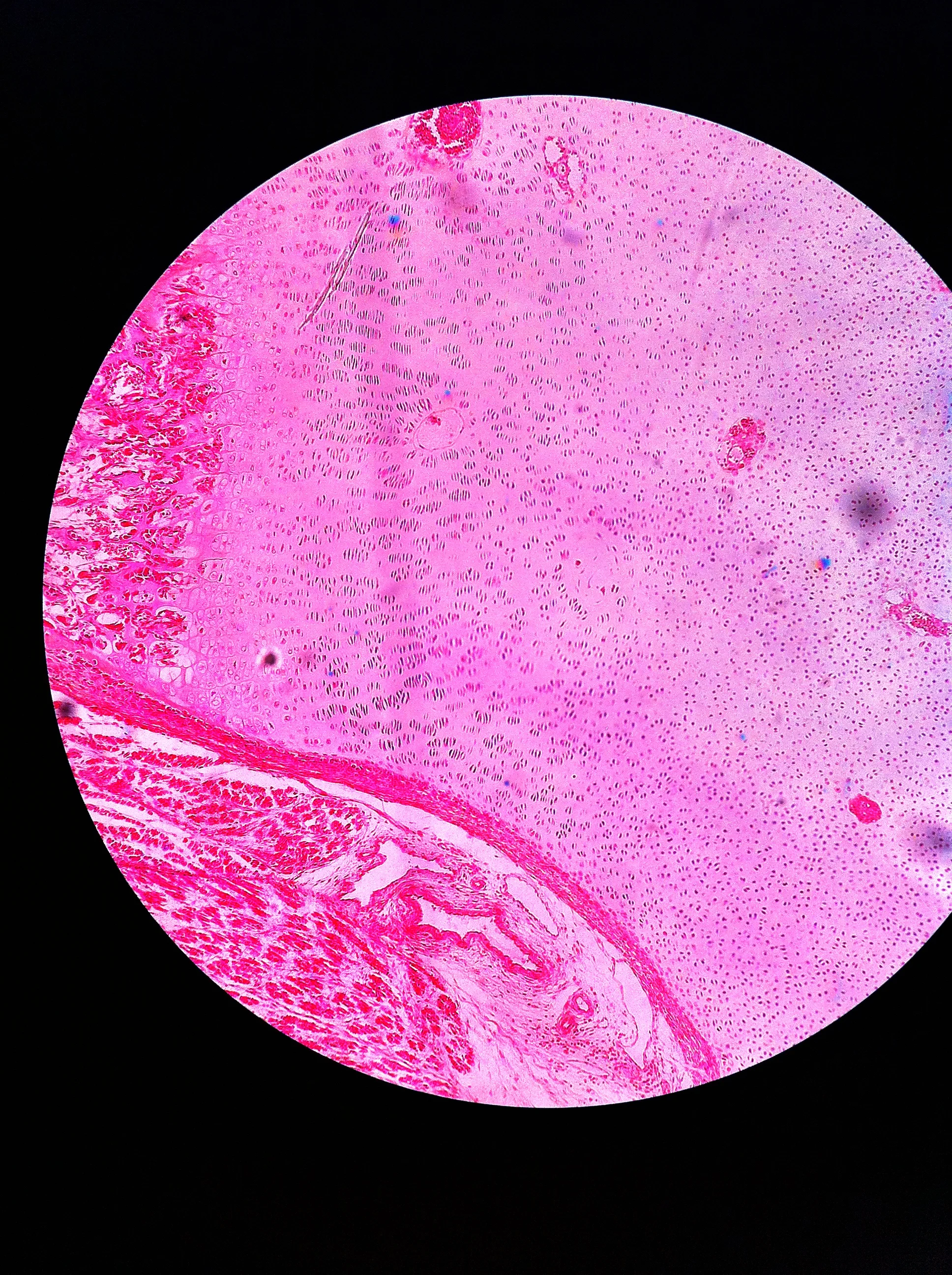 Bone Anatomy — See Why Anatomy