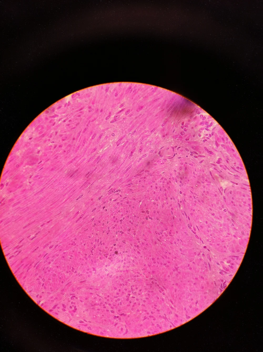 Smooth Muscle Tissue 400x