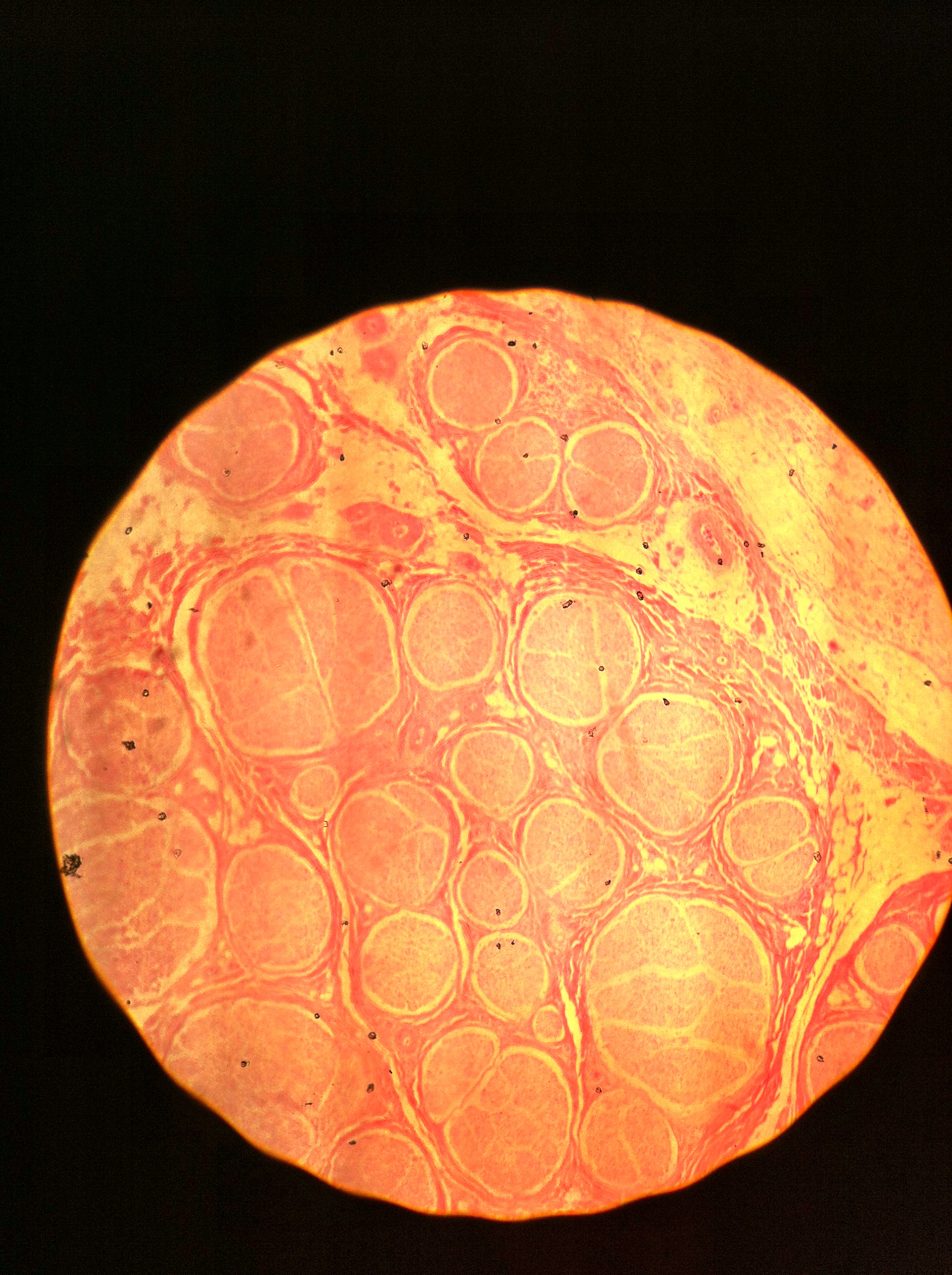 Nervous System — See Why Anatomy