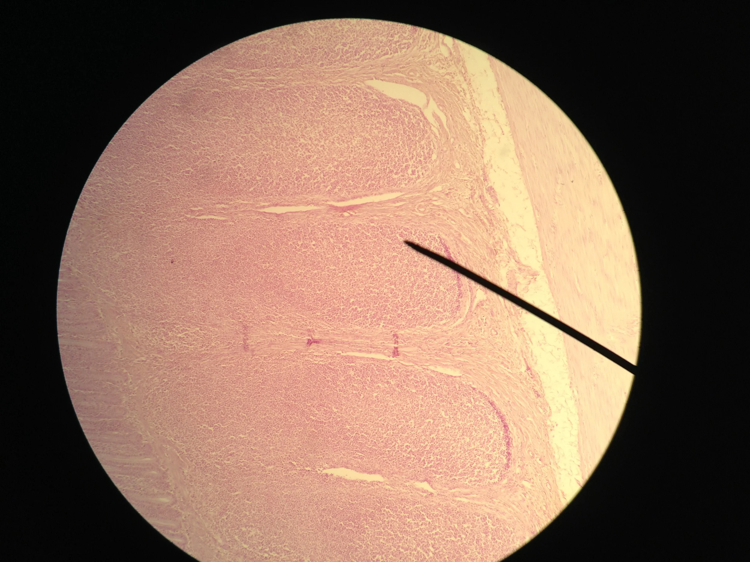 Lymphatic System — See Why Anatomy