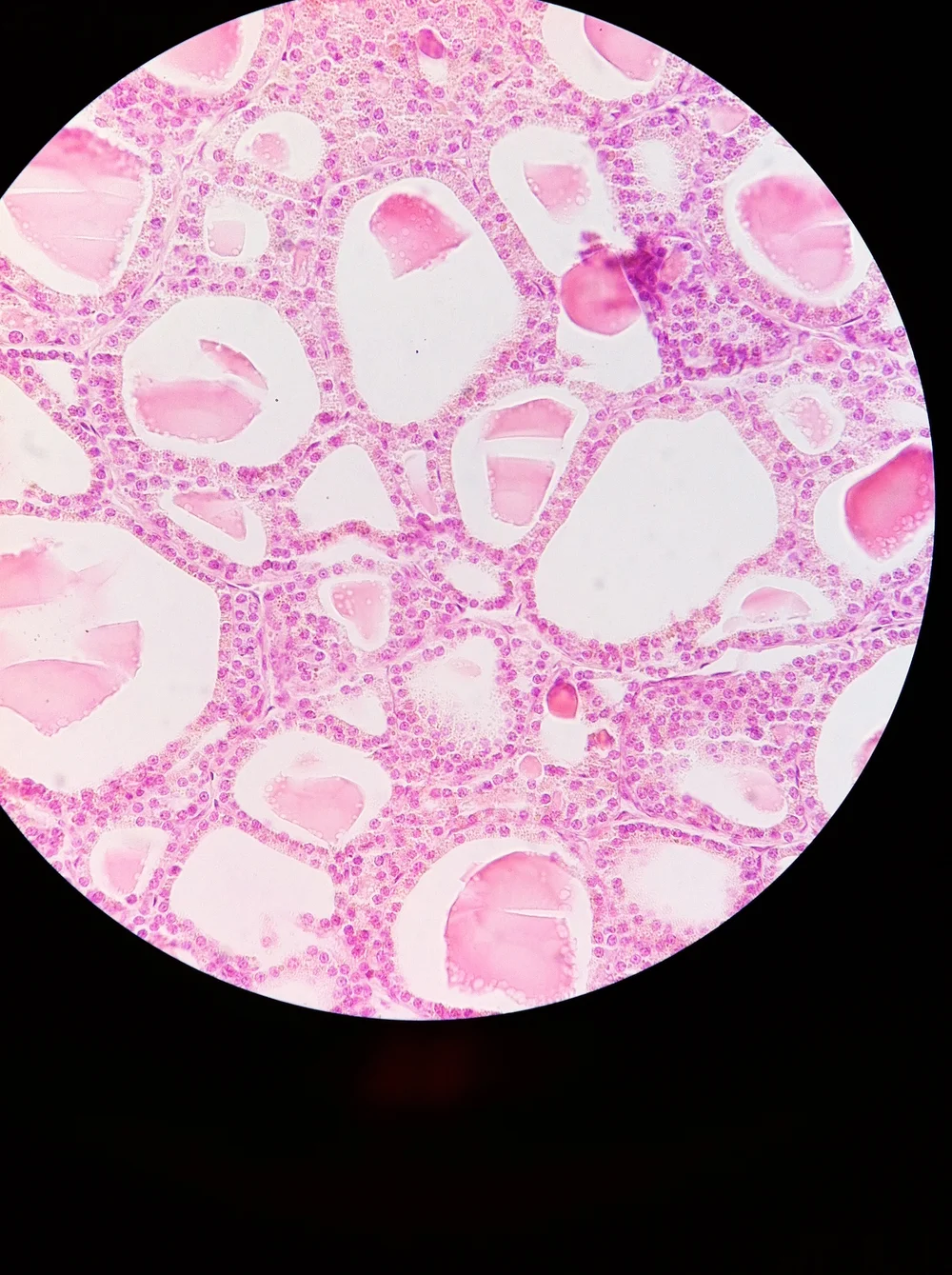 Neuron Microscope 400x